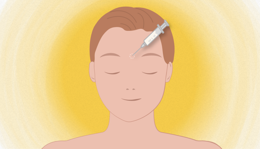 Botox for Migraine - Migraine World Summit